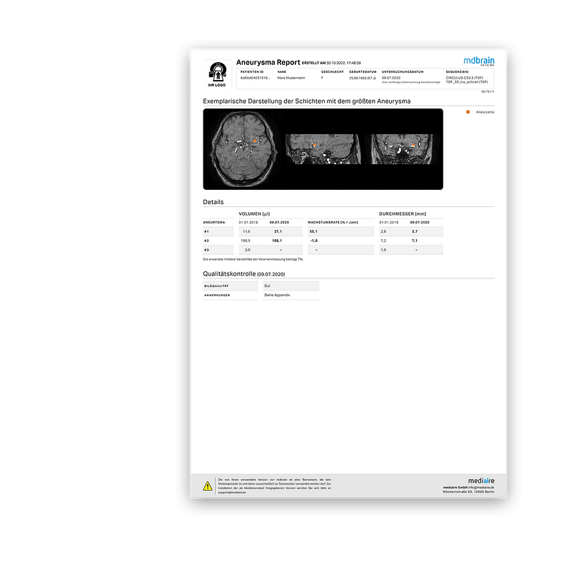 Detection of aneurysms